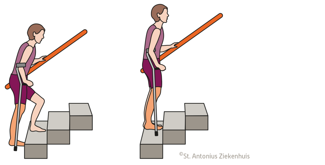 Fysiotherapie na een heupprothese | St. Antonius Ziekenhuis