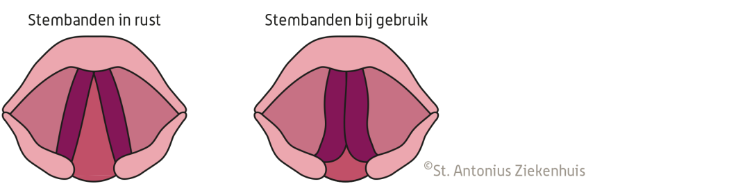 Stembandenonderzoek (microlaryngoscopie) | St. Antonius Ziekenhuis