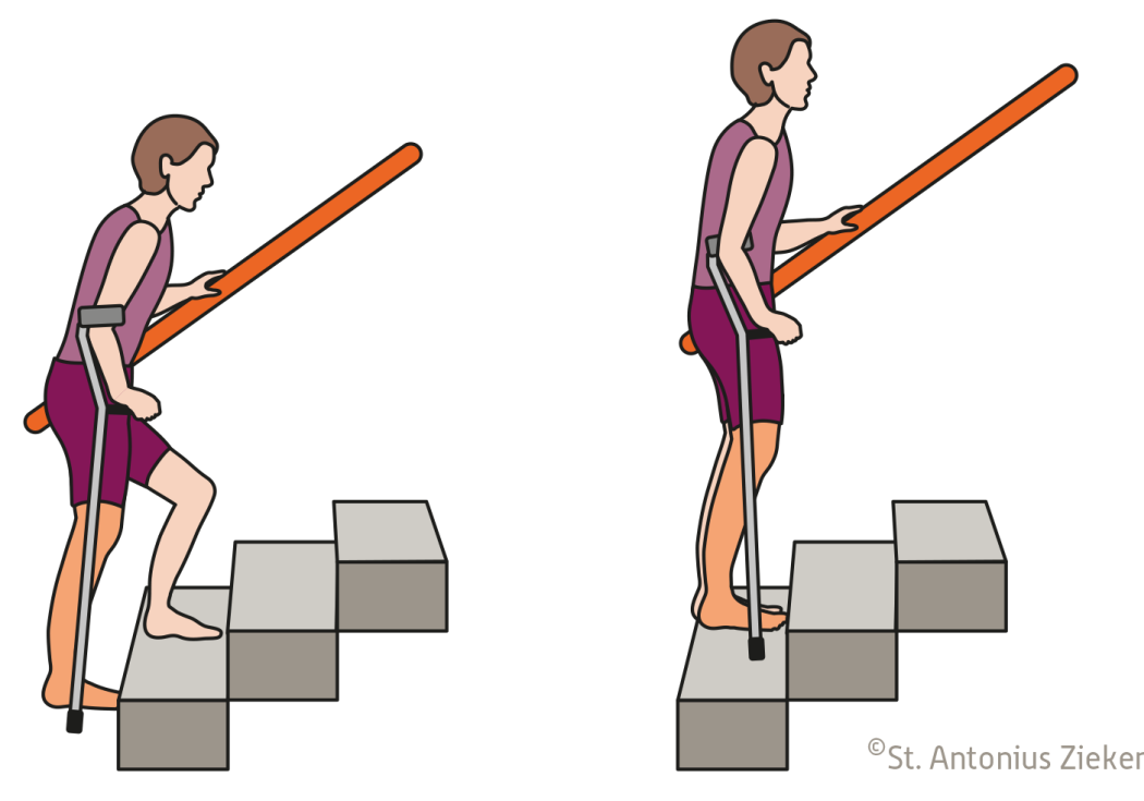 Fysiotherapie na een meniscusoperatie | St. Antonius Ziekenhuis