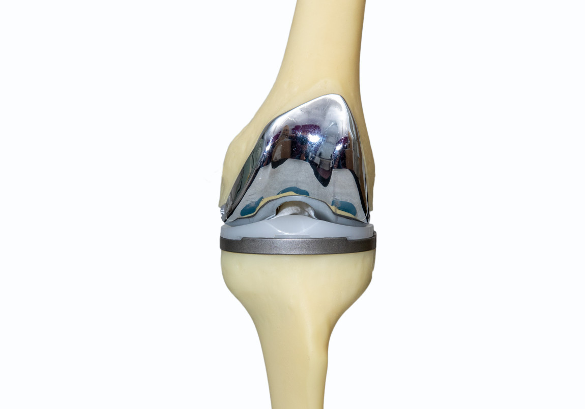 Knieprothese | St. Antonius Ziekenhuis