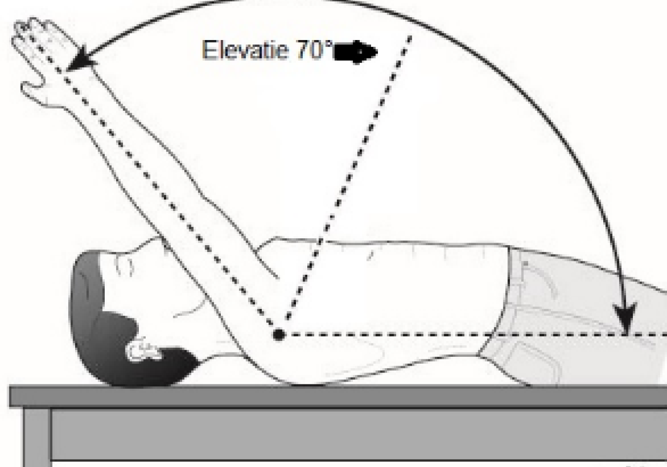 Schouderluxatie: revalidatie en herstel | St. Antonius Ziekenhuis