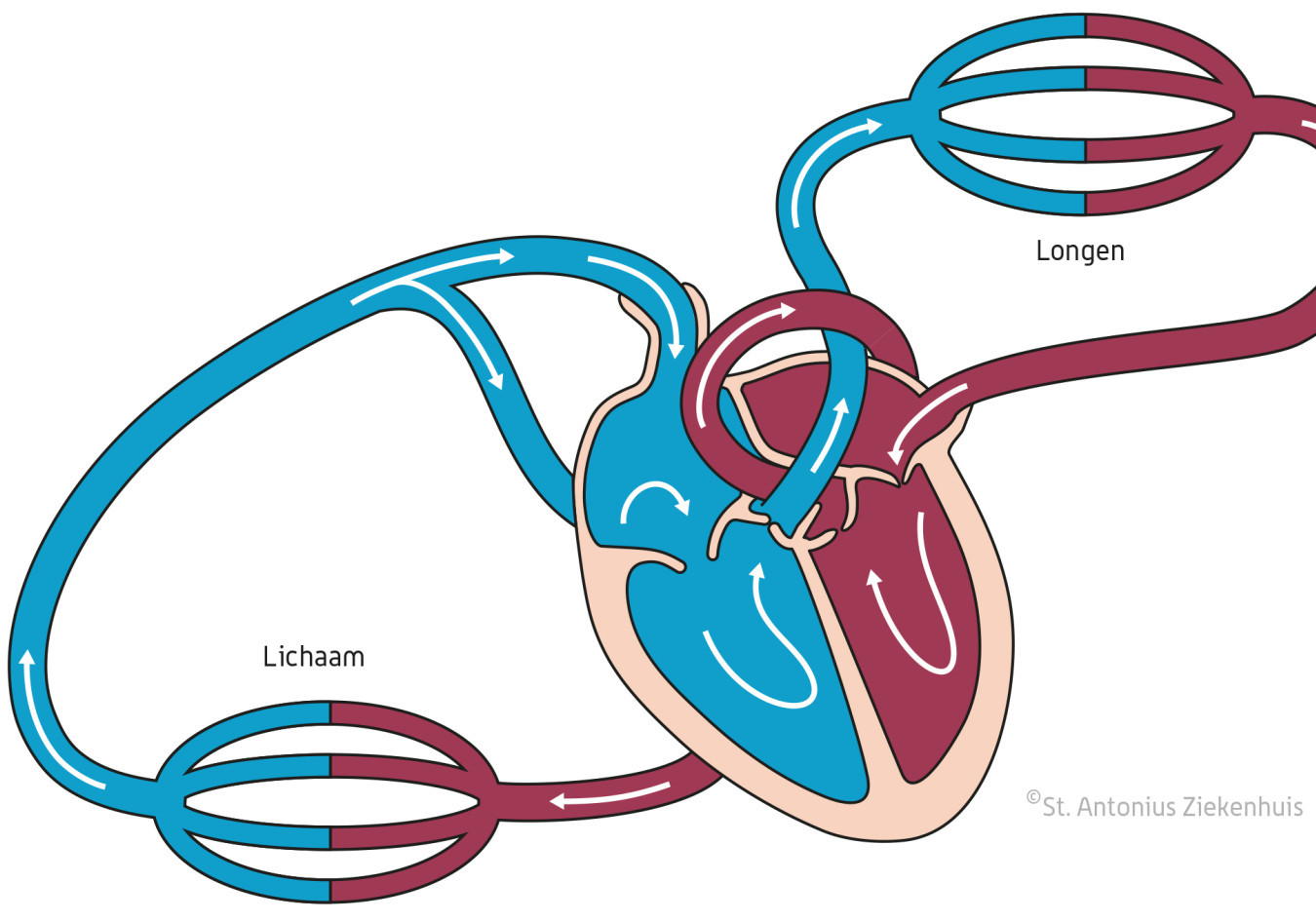 Ablatie | St. Antonius Ziekenhuis