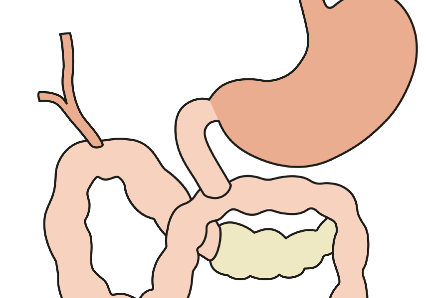 Alvleesklieroperatie | St. Antonius Ziekenhuis