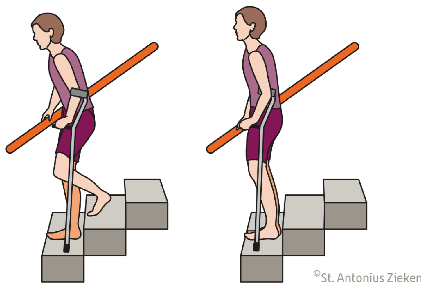 Fysiotherapie na een heupprothese | St. Antonius Ziekenhuis