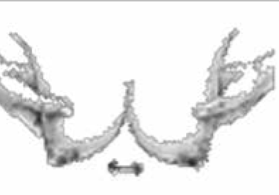 Kolven en kolfdagboek | St. Antonius Ziekenhuis