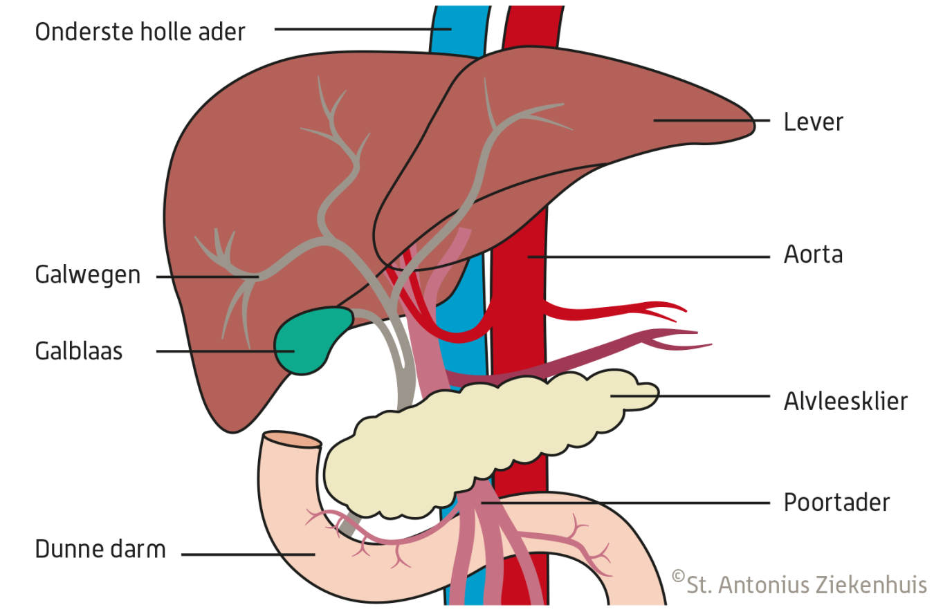 Galwegdrainage (Percutane Transhepatische Cholangiografie) | St ...