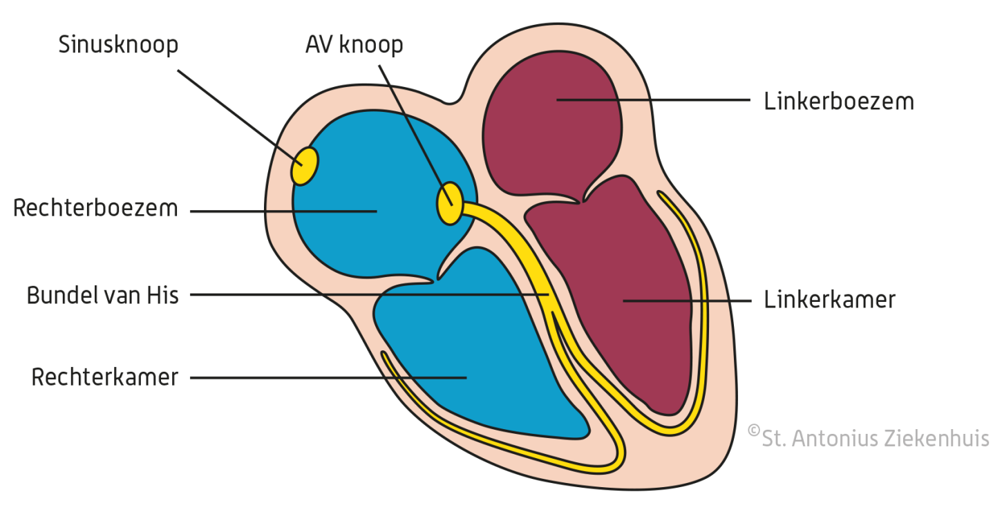 Pacemaker | St. Antonius Ziekenhuis