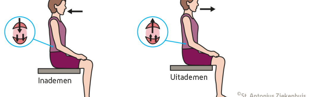Oefeningen voor de bekkenbodem | St. Antonius Ziekenhuis