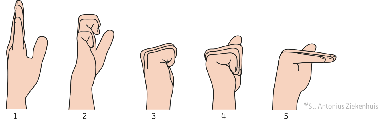Algemene oefeningen voor de hand | St. Antonius Ziekenhuis