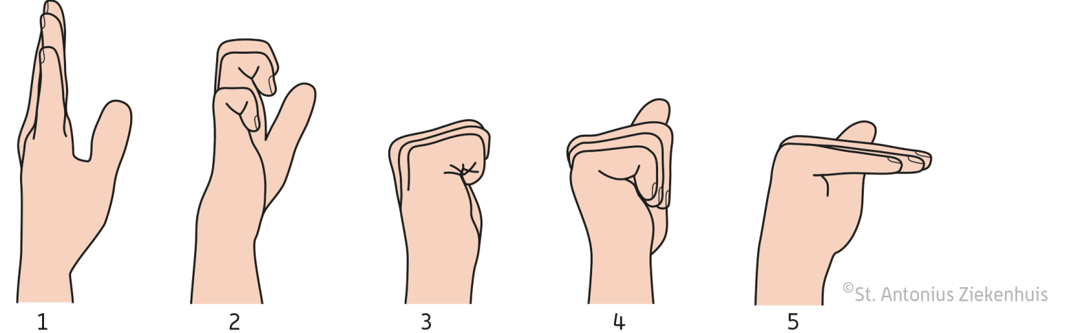 Algemene oefeningen voor de hand | St. Antonius Ziekenhuis