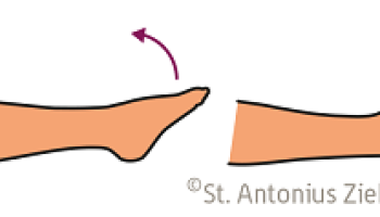 Oefeningen tijdens en na gebruik van de achillotrain (conservatief ...