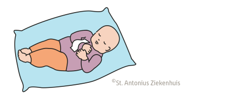 Baby geboren met een schouderdystocie en/of gebroken sleutelbeentje | St. Antonius Ziekenhuis