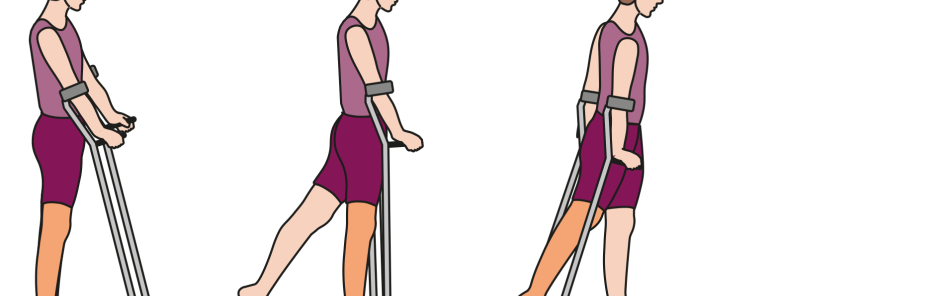 Fysiotherapie na een meniscusoperatie | St. Antonius Ziekenhuis