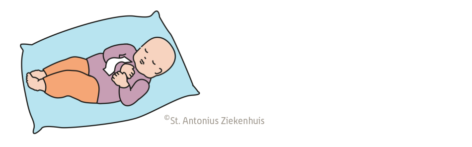 Baby geboren met een schouderdystocie en/of gebroken sleutelbeentje | St. Antonius Ziekenhuis