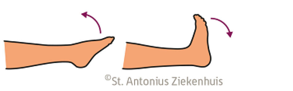 Fysiotherapie na een knieprothese | St. Antonius Ziekenhuis