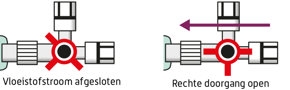Naar huis met een percutane galwegdrain (PTC) | St. Antonius Ziekenhuis