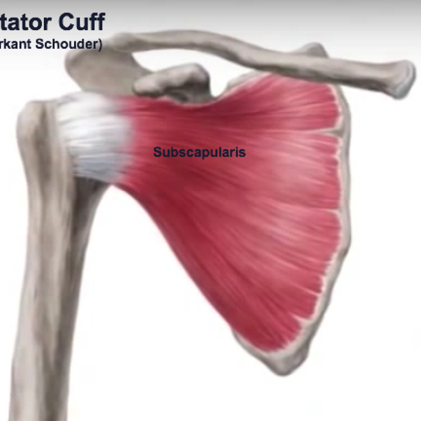 Artrose van de schouder (slijtage) | St. Antonius Ziekenhuis