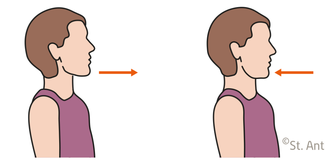 Fysiotherapie na het verwijderen van de eerste rib | St. Antonius ...