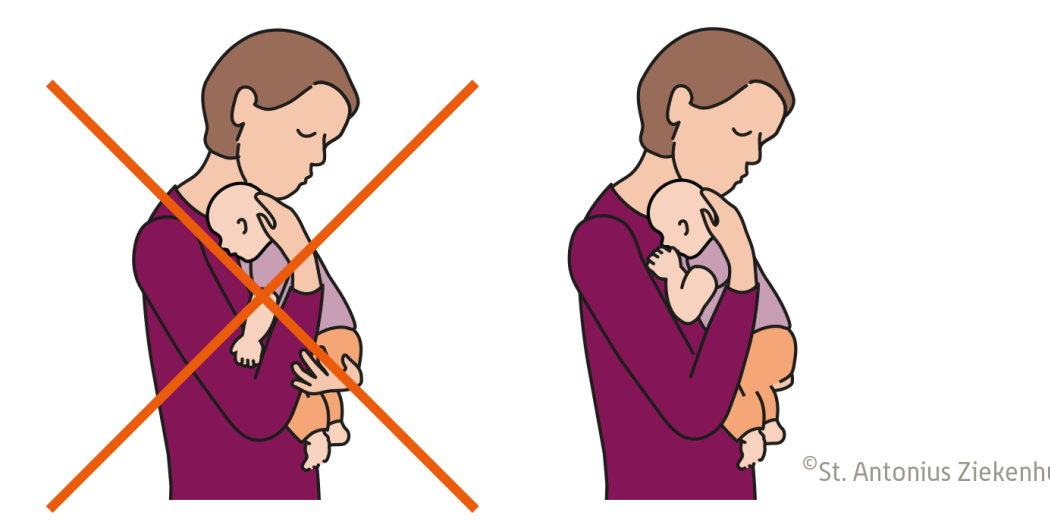 Baby geboren met een schouderdystocie en/of gebroken sleutelbeentje | St. Antonius Ziekenhuis