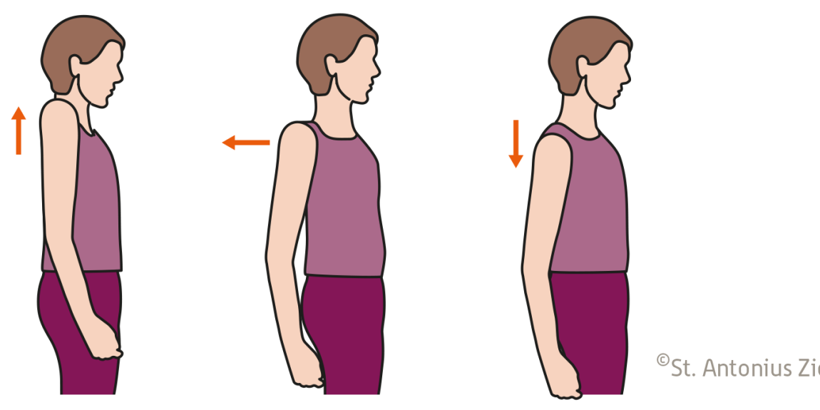 Fysiotherapie na het verwijderen van de eerste rib | St. Antonius ...