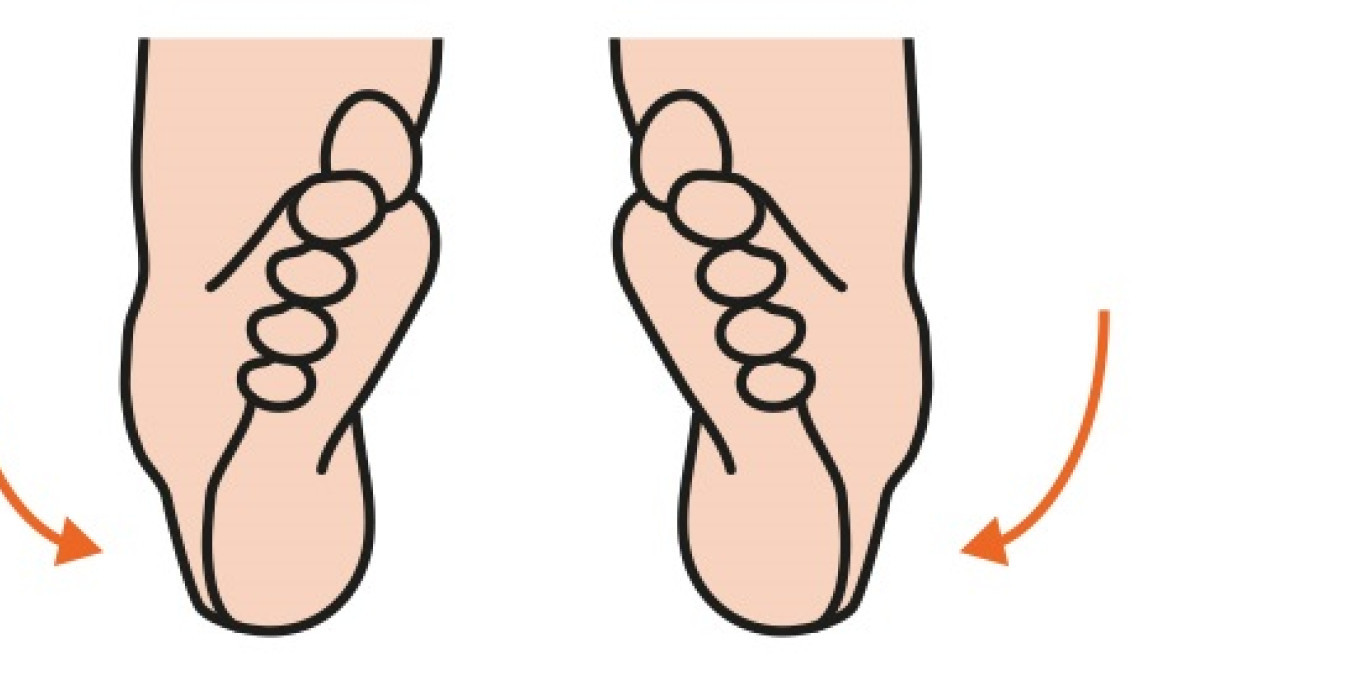 Oefeningen tijdens en na gebruik van de achillotrain (conservatief ...
