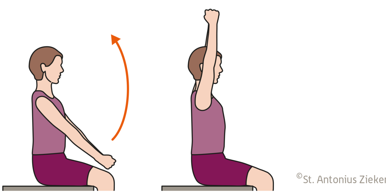 Fysiotherapie na het verwijderen van de eerste rib | St. Antonius ...