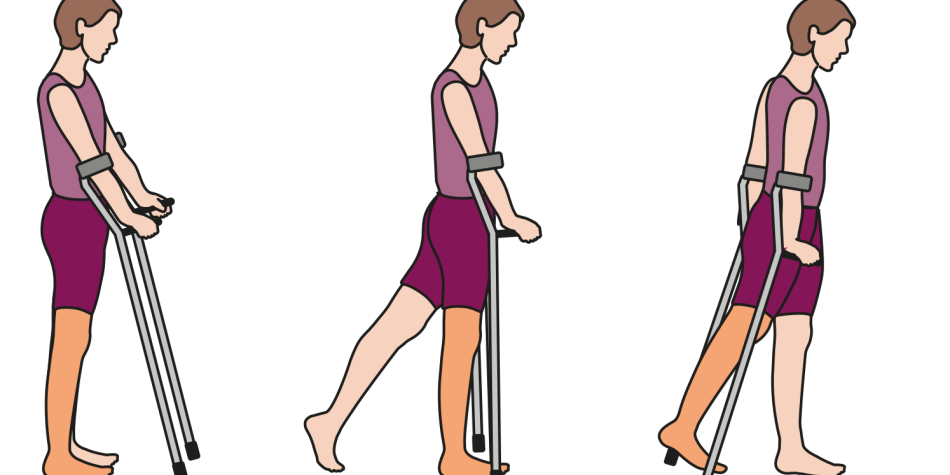 Fysiotherapie na een knieprothese | St. Antonius Ziekenhuis