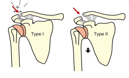 collar bone movement