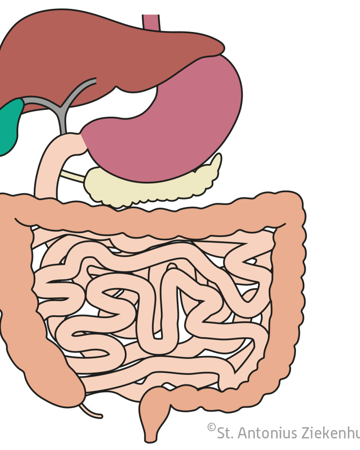 Blindedarmontsteking bij kinderen (behandeling) | St. Antonius Ziekenhuis