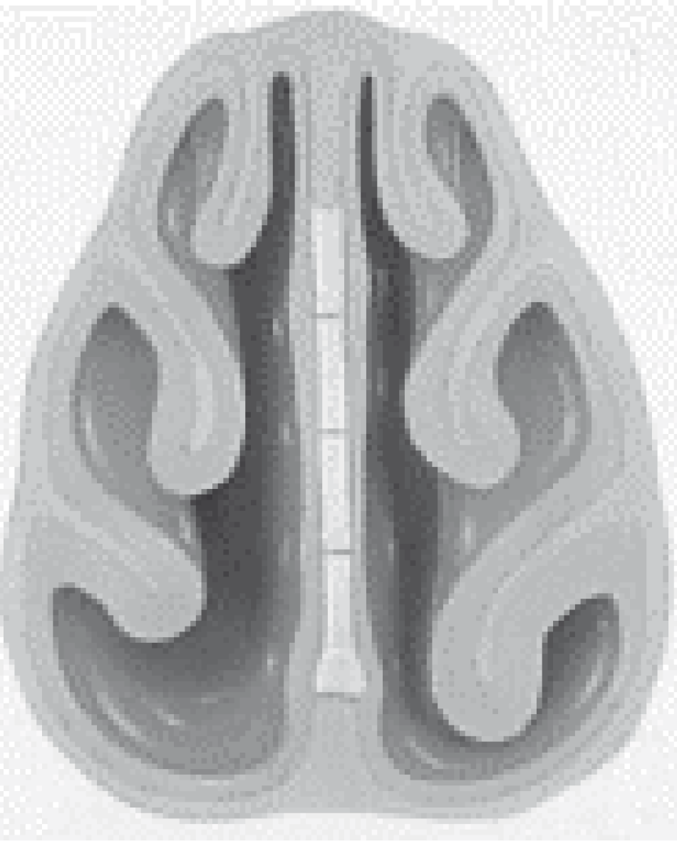 Neusoperaties | St. Antonius Ziekenhuis