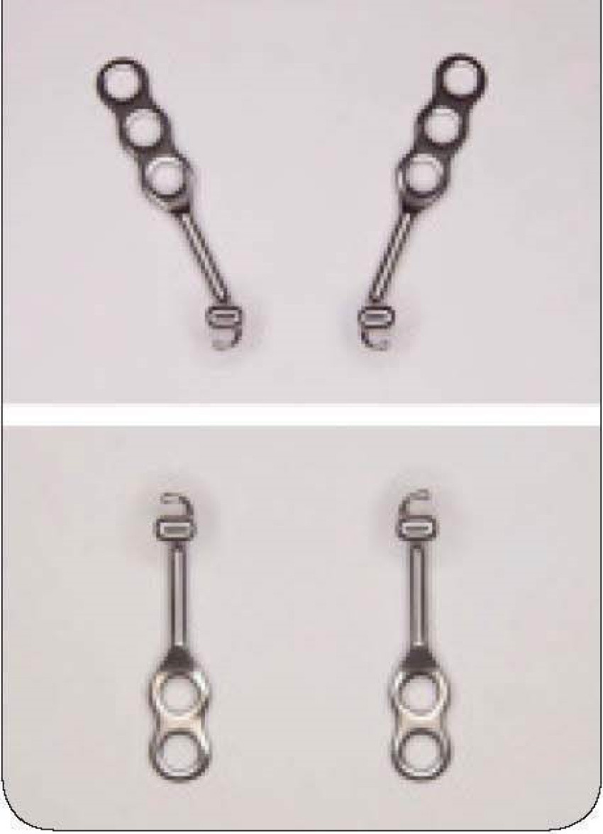 Botanker of orthodontisch schroefje plaatsen en verwijderen | St ...